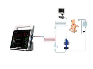 Set-Up in 5 steps – Step 1 – Hemodynamic Management / Vygon