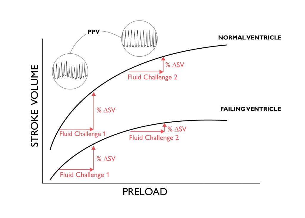 Perioperative optimisation – Hemodynamic Management / Vygon