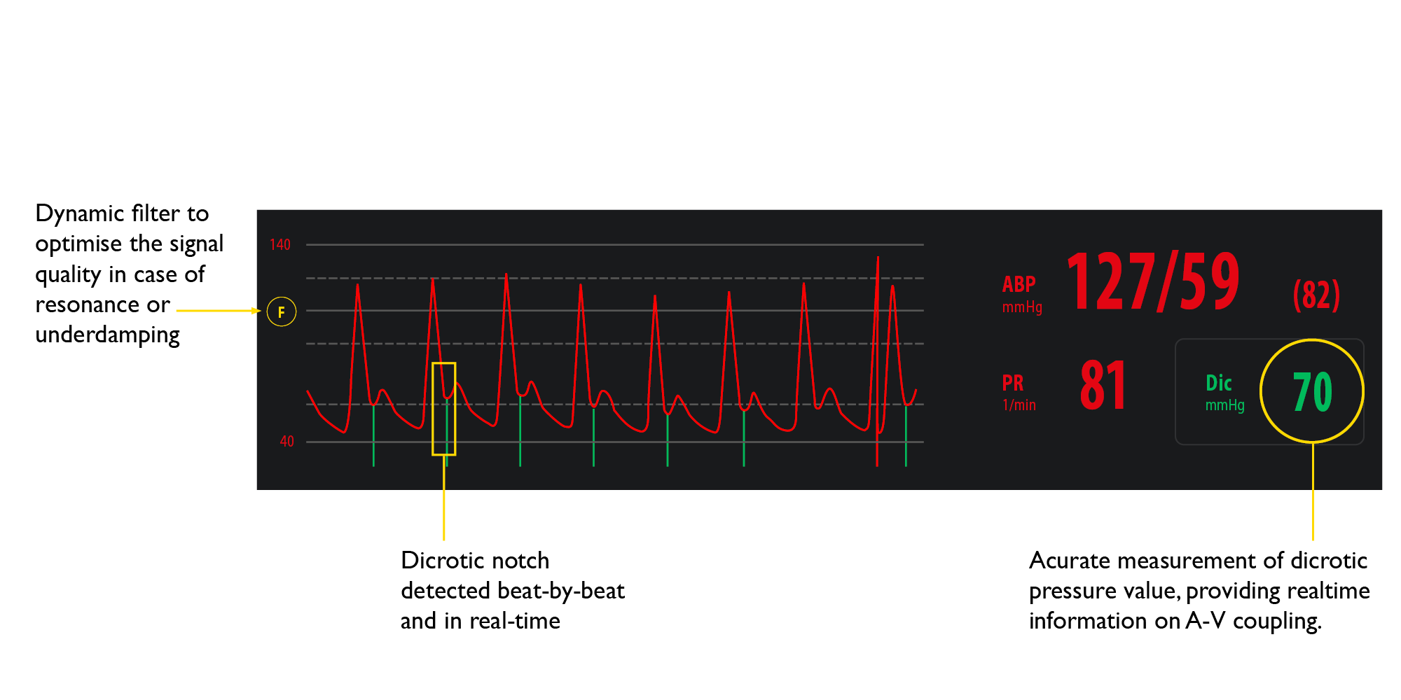 User interface – Hemodynamic Management / Vygon