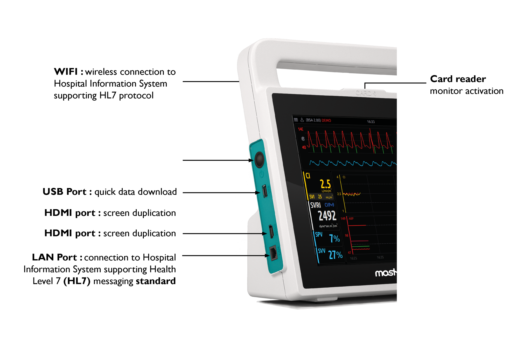 MostCare Up: the Vygon monitoring system for hemodynamic management ...